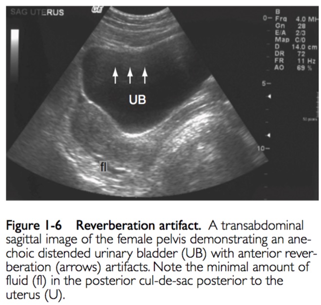 READING SONOGRAMS - A GUIDE