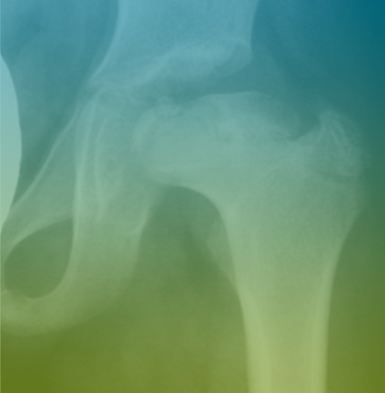 M. Perthes - Stehen und Gehen | Praxis Zeppelin