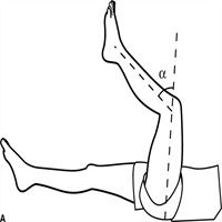 Healthy Hamstrings 3. Are they tight, and does it matter?