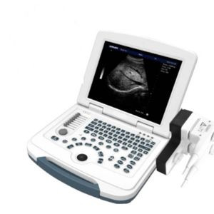B/W Ultrasound Machine | Monega Enterprises