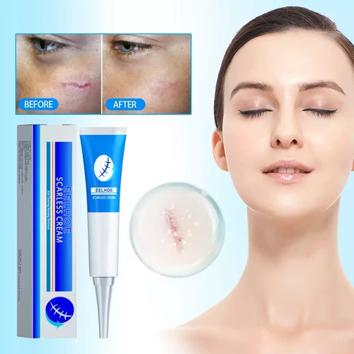 Scar Eraser Removal Cream Gel Stretch Mark Surgical Acne Skin Care ...