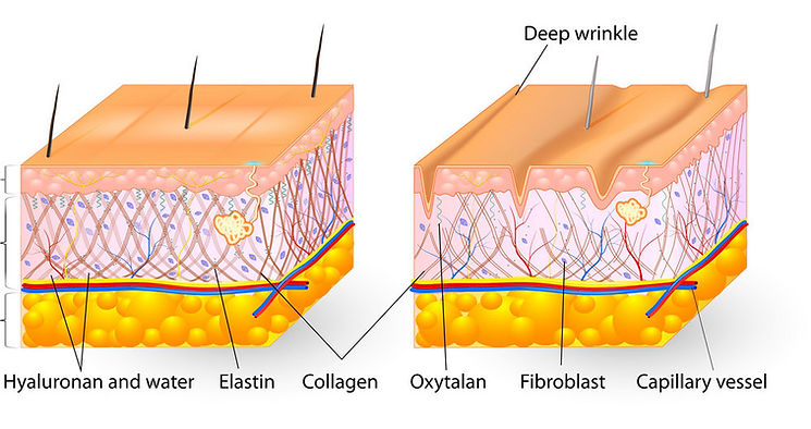 B-Sculpt Medispa | Laser skin rejuvenation Montreal