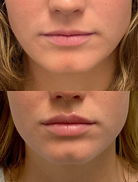 TREATMENTS | Muse Aesthetics