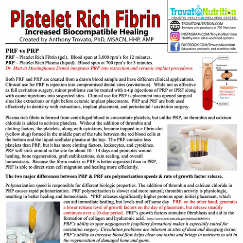 Platelet Rich Fibrin Handout | Trovato Nutrition