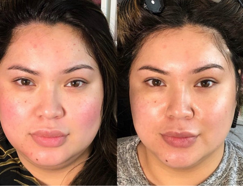 How I transformed my Skin