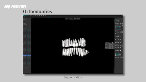 MEYER CBCT- Your Reliable Choice | MagnifiDENT