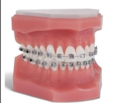 Typodont - Orthodontic | MagnifiDENT