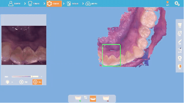 DEMO PANDA 2 IntraOral 3D Imaging Scanner - IO3dS | magnifidentcc