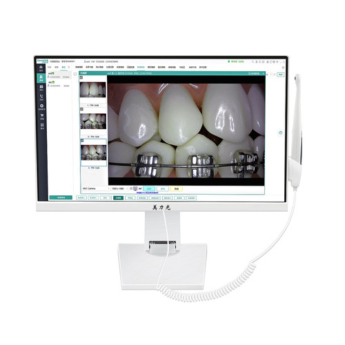 IntraOral Camera System+PC Touchscreen - 4K ULTRAHD | MagnifiDENT