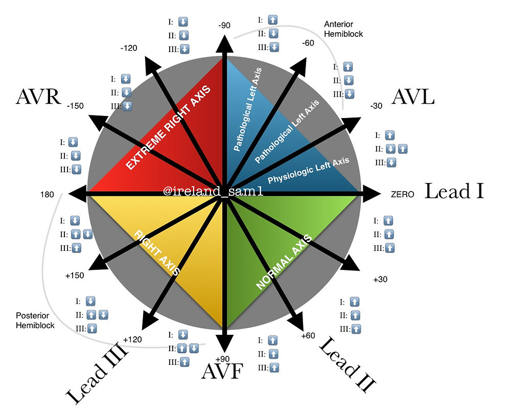 3 Reasons You Should Know Cardiac Axis