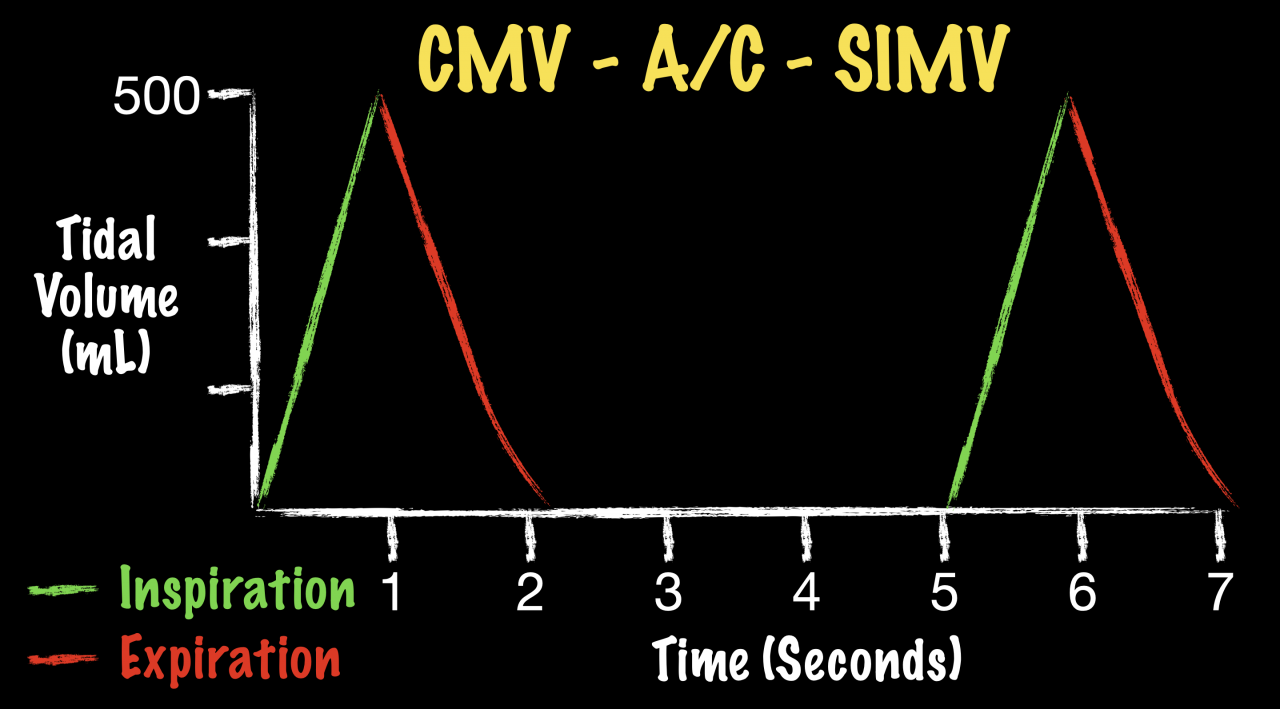 Difference Between CMV and SIMV..