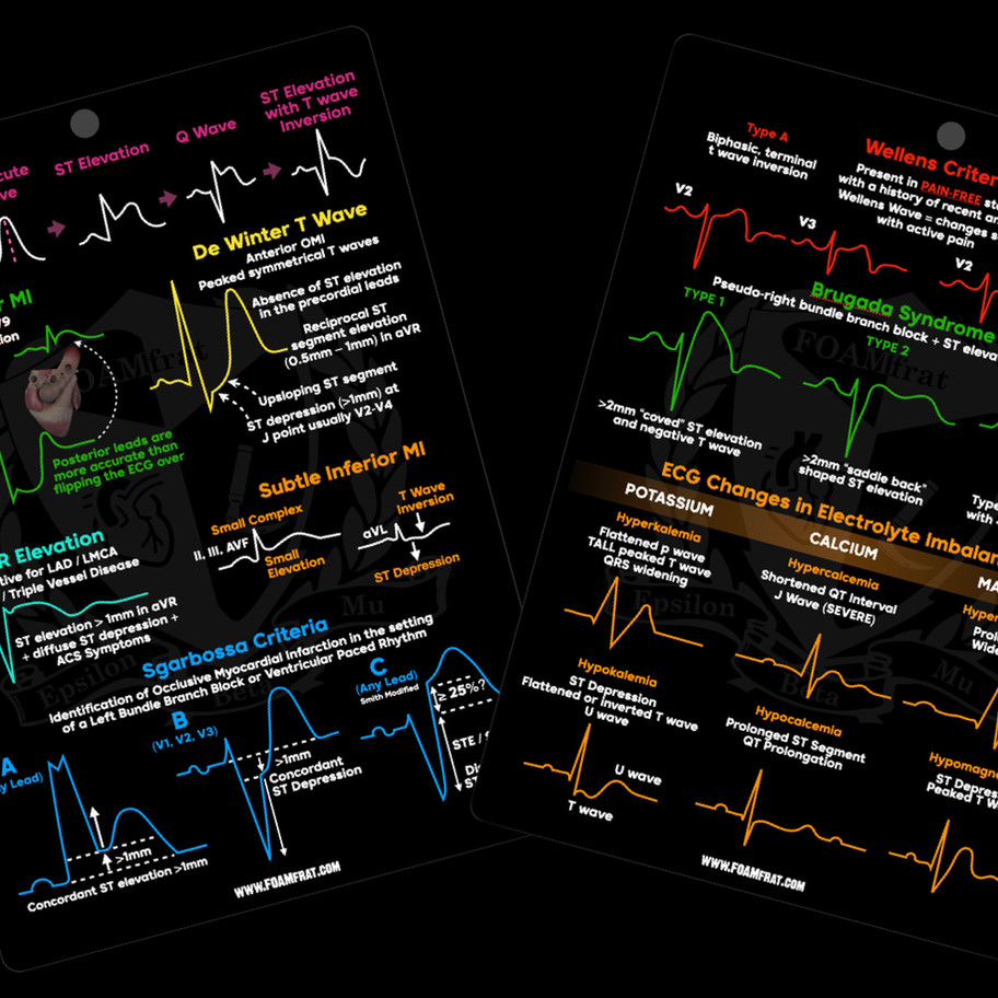The ECG Card | FOAMfrat