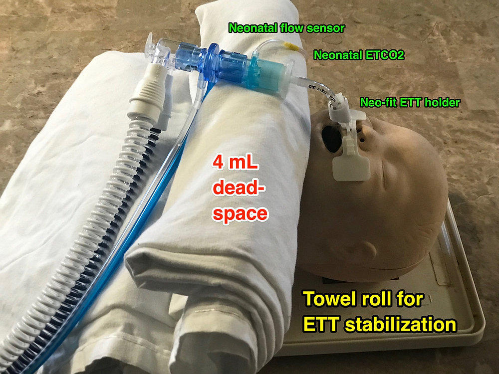 Podcast 70 - Pediatric Ventilation with the Hamilton T1
