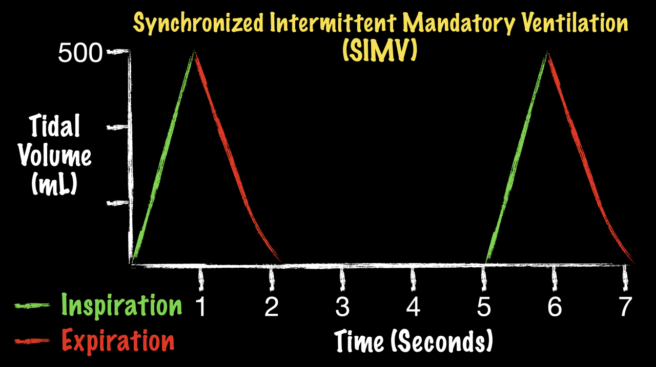 Difference Between CMV and SIMV..
