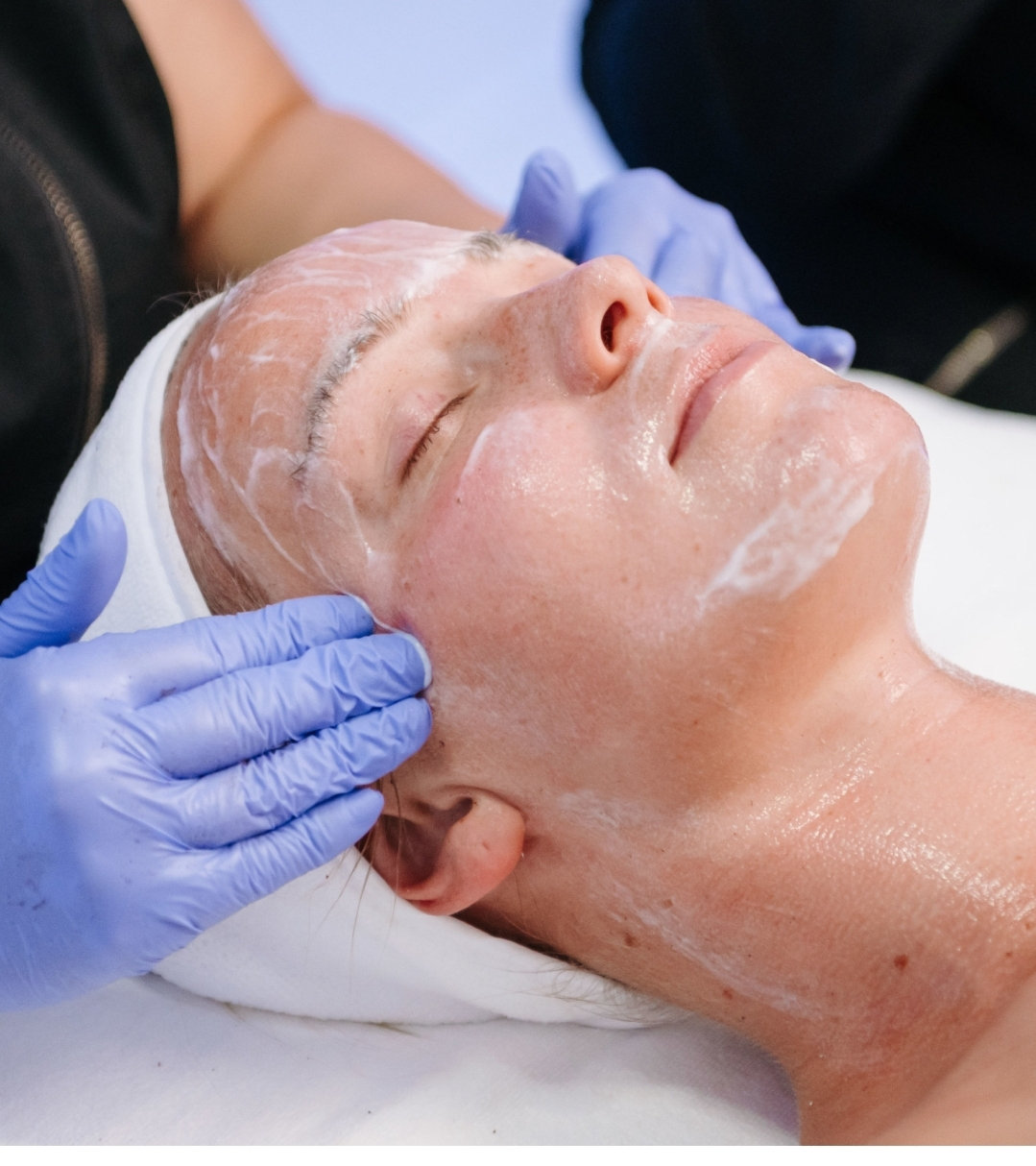 Skin Concern: Rosacea / Acne / Ruddy Looking Skin