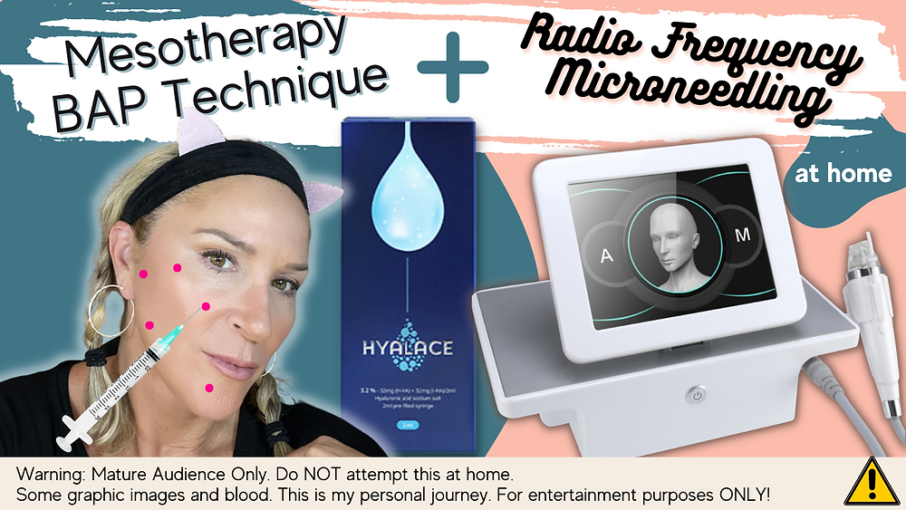 Mesotherapy using BAP Technique plus Morpheus8 Radio Frequency ...