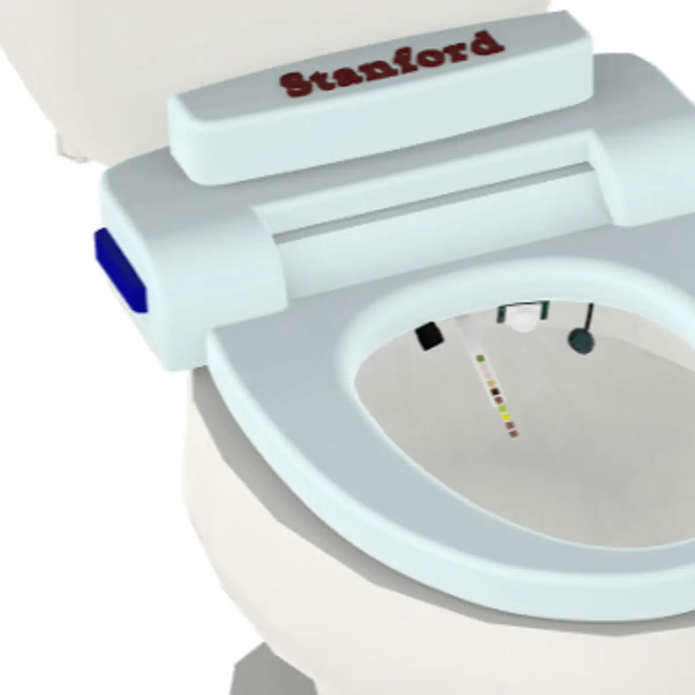 ‘Smart toilet’ monitors for signs of disease, Stanford research finds