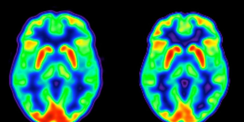 Amazing good news about how menopause changes your brain