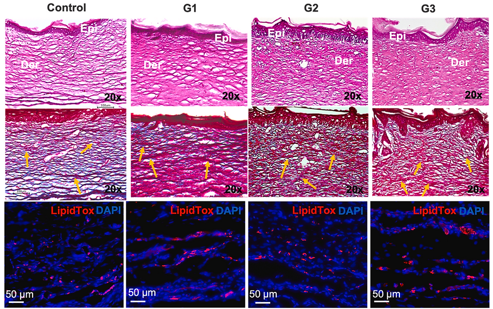3D printed living skin and hair follicles revolutionize reconstructive ...