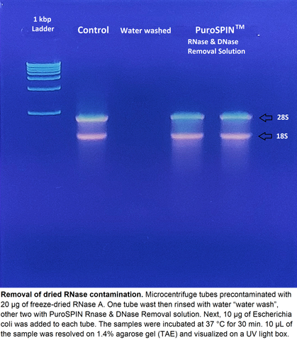 PuroSPIN™ RNase & DNase Removal Solution | Luna Nanotech