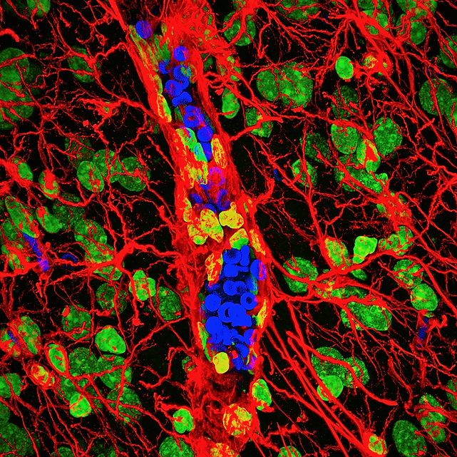 Confocal microscopy | Danielle Beckman
