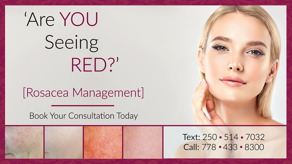 Are you seeing red? Rosacea Management - Book Your Consultation Today