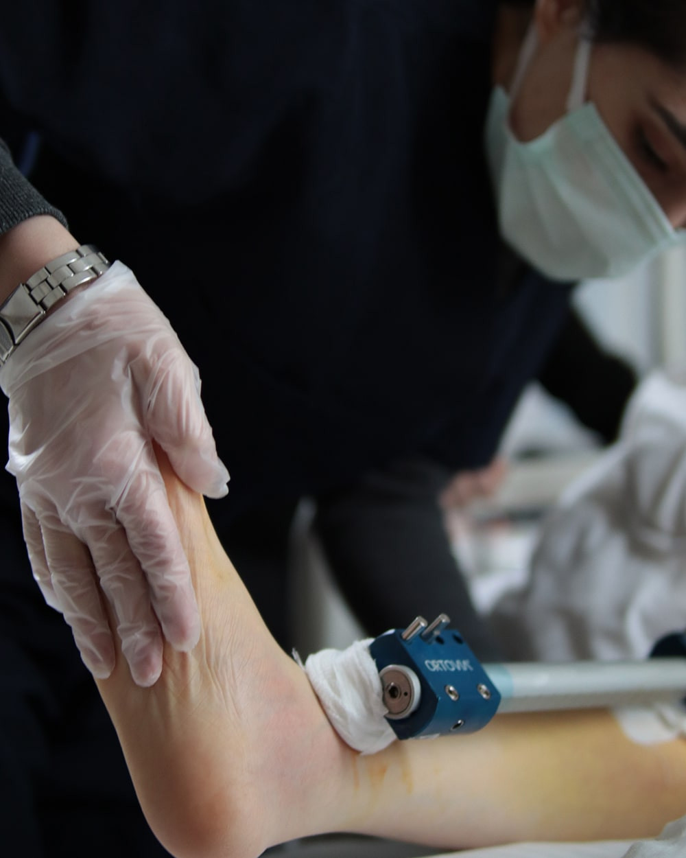 Limb Lengthening Surgery: Risks, Complications, and Side Effects