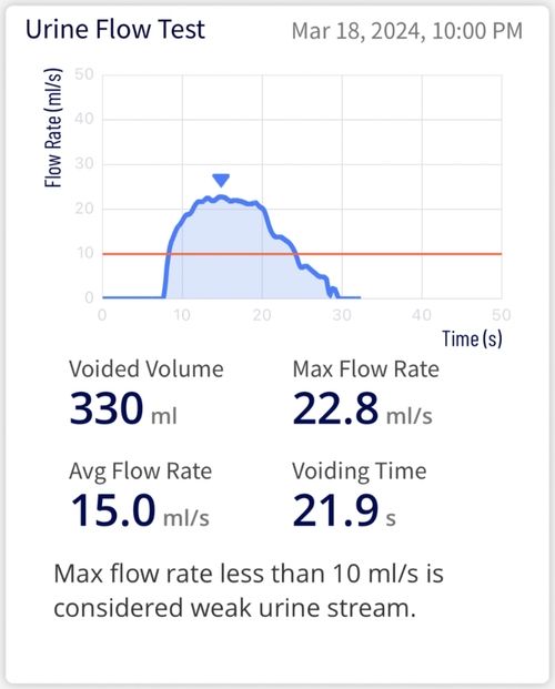 Uroflowmetry: A Quick Test to Measure Urine Flow