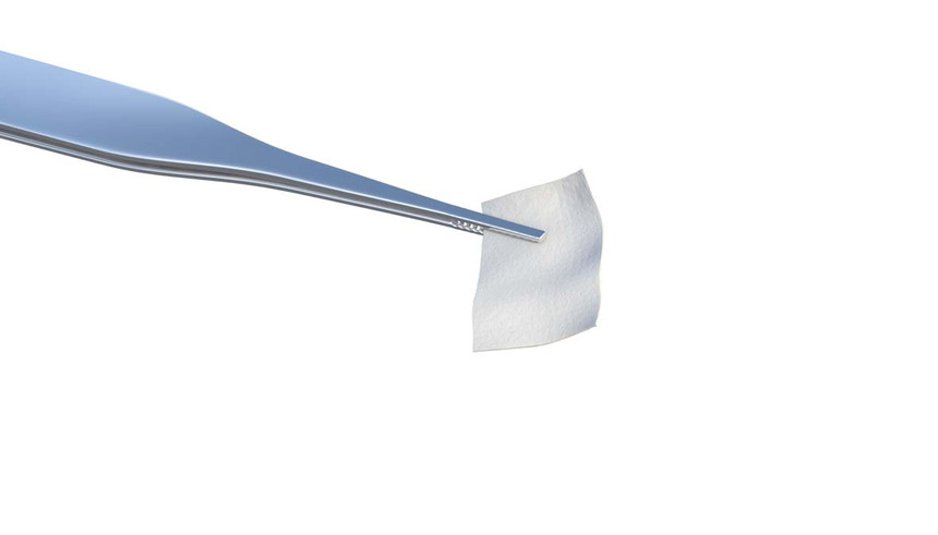 CorNeat Vision Completes Pre-clinical Phase For Synthetic Cornea and ...