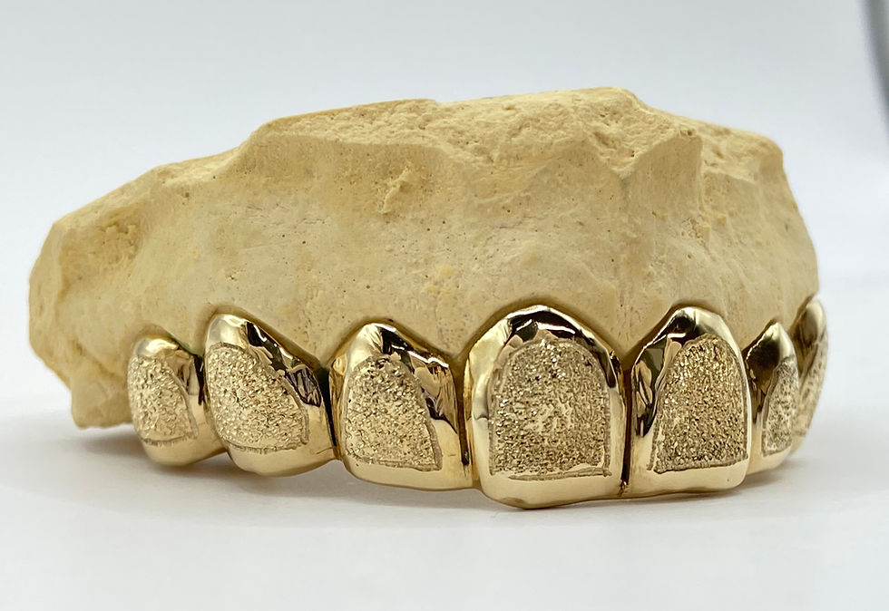 Fronts / Grillz | Baltimore Gold Fronts | United States