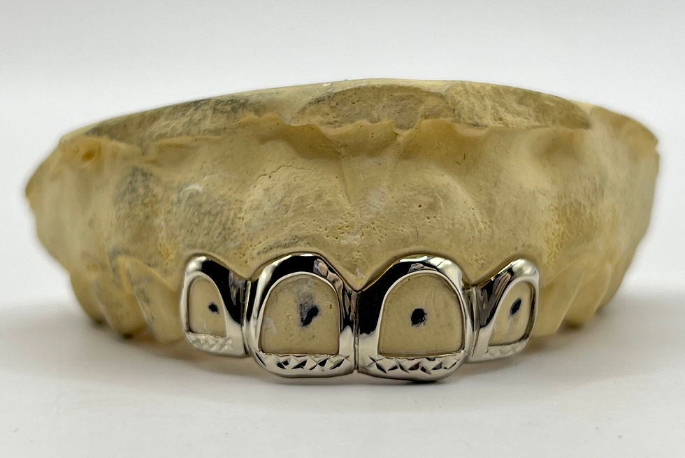 Fronts / Grillz | Baltimore Gold Fronts | United States