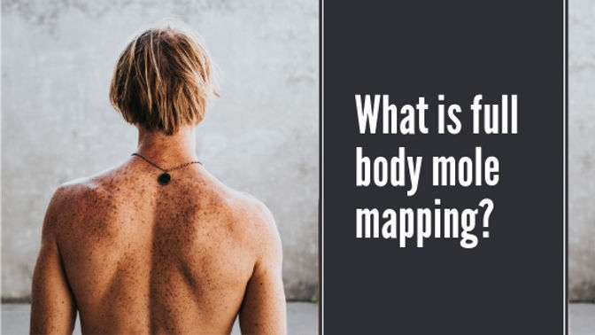 What is full body mole mapping? | The Clinic