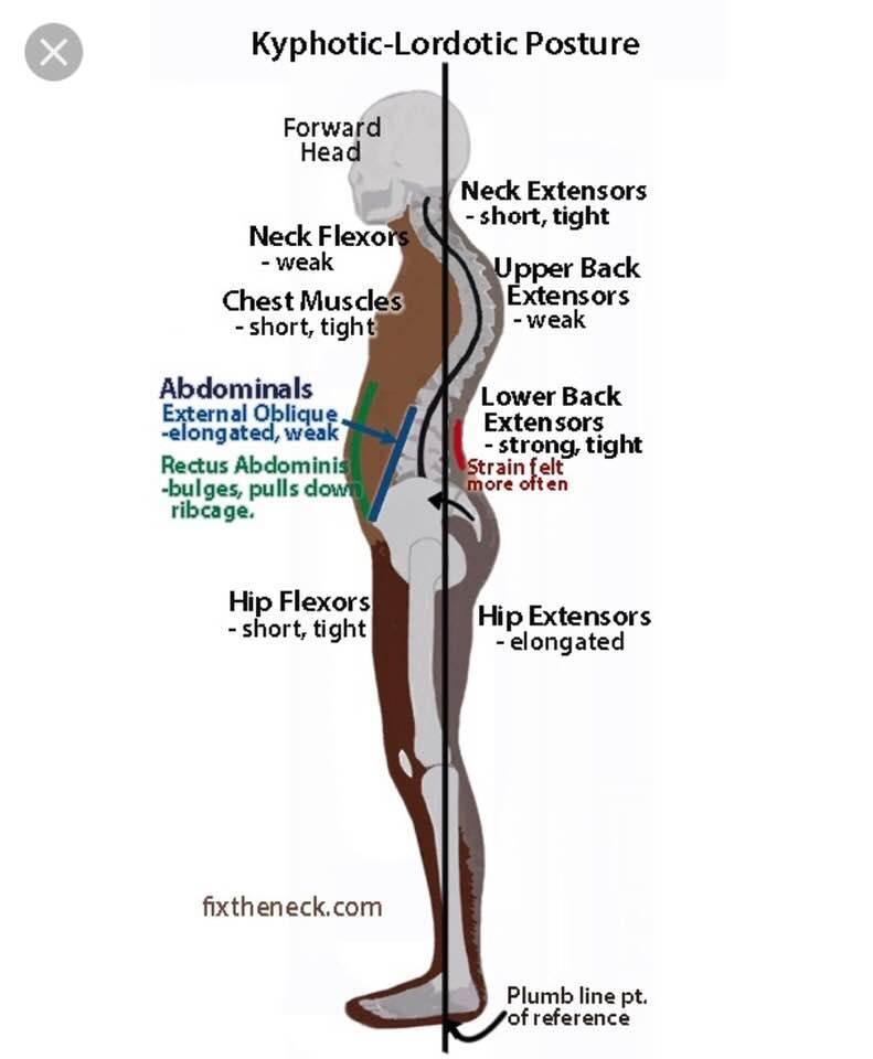 ACE CPT Prep / Chapter 7 / Functional Assessments