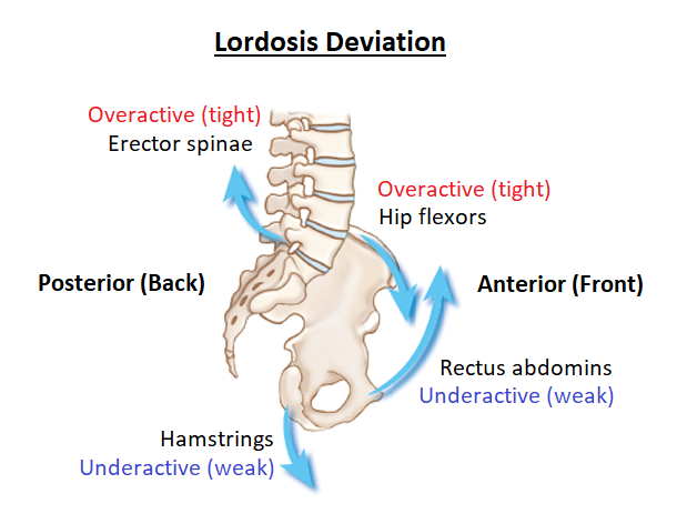 Overactive / Underactive Muscles. Everything you need to know.