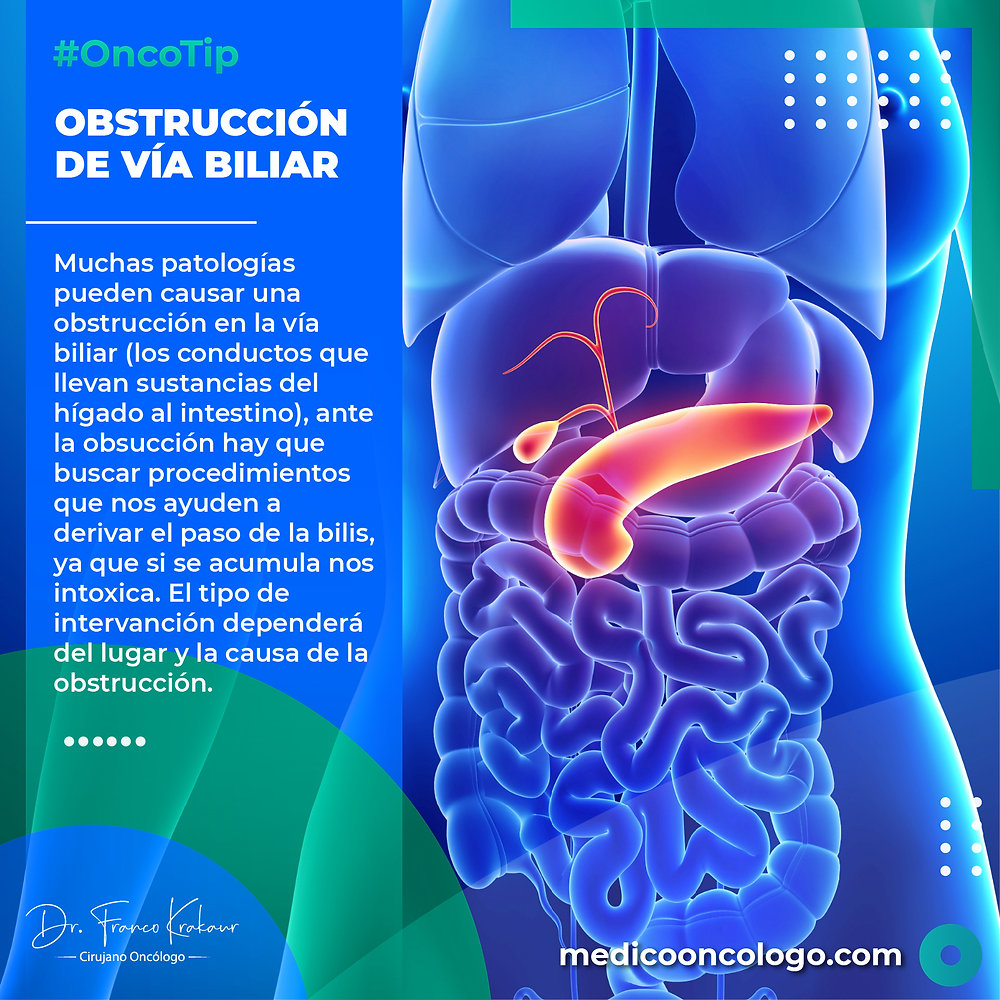 "Obstrucción De Vía Biliar"|Dr. Franco Krakaur | Cirujano Oncólogo