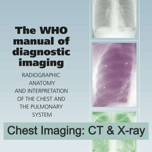 Radiology CEU: CT & X-Ray - 15 Radiology CE Credits