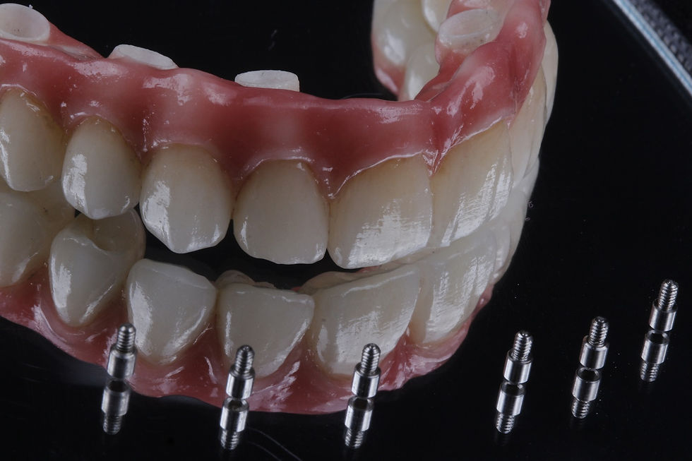 Protocolo de acrílico ou porcelana?