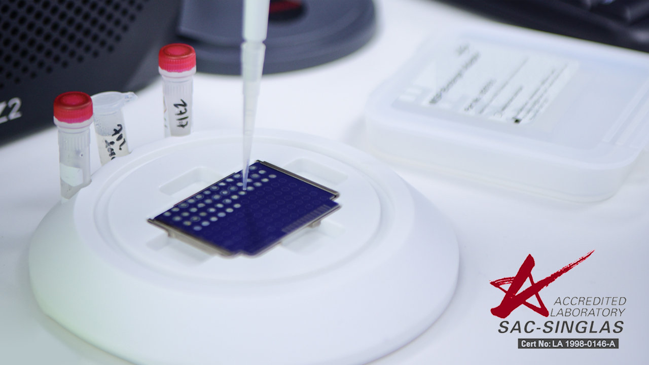 Ugene Laboratory’s Rapid 24-Hour Test Service Achieves Widened ...