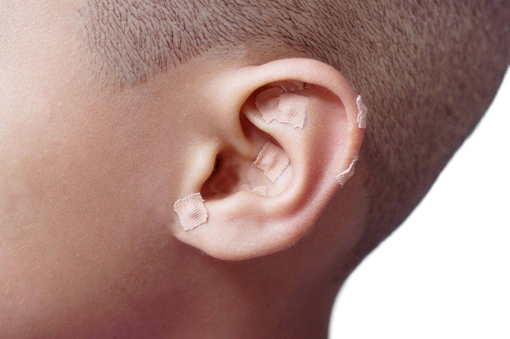 ear-seeds-benefits-how-to-use-evidence-and-safety