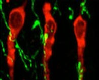 Research | PCOS Research NZ