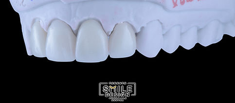 Revitalizing Smiles: A Deep Dive into Cosmetic Dentistry Solutions for ...
