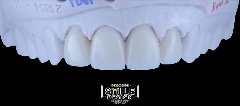 Revitalizing Smiles: A Deep Dive into Cosmetic Dentistry Solutions for ...