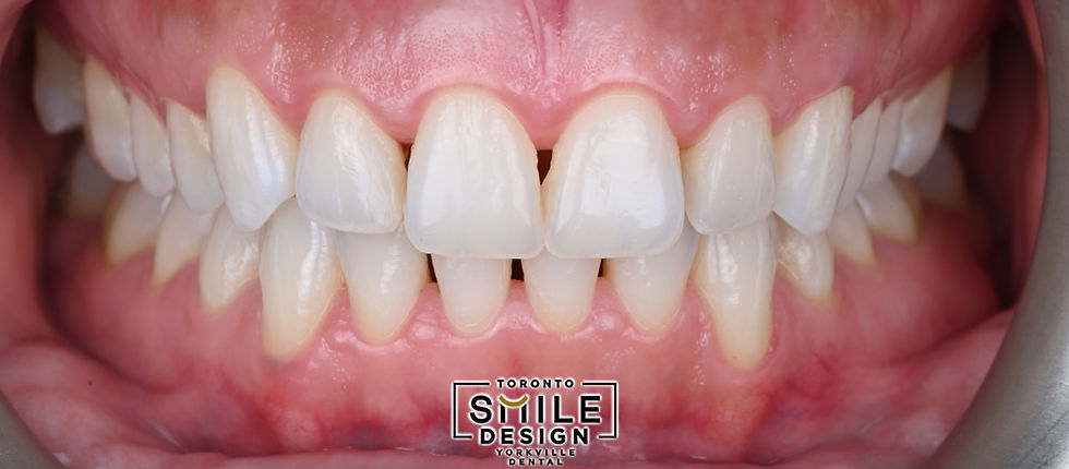 Revitalizing Smiles: A Deep Dive into Cosmetic Dentistry Solutions for ...