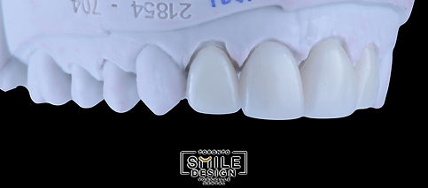 Revitalizing Smiles: A Deep Dive into Cosmetic Dentistry Solutions for ...