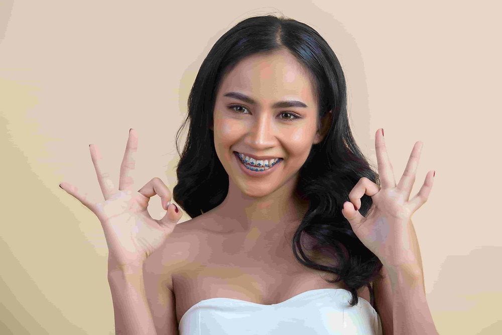 Braces Vs Invisalign A Comprehensive Guide