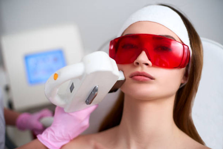 Unveiling Smooth Skin: The Ultimate Guide to Laser Hair Removal
