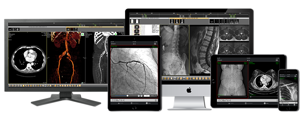 Exa Enterprise Imaging | Enterprise Imaging Solution