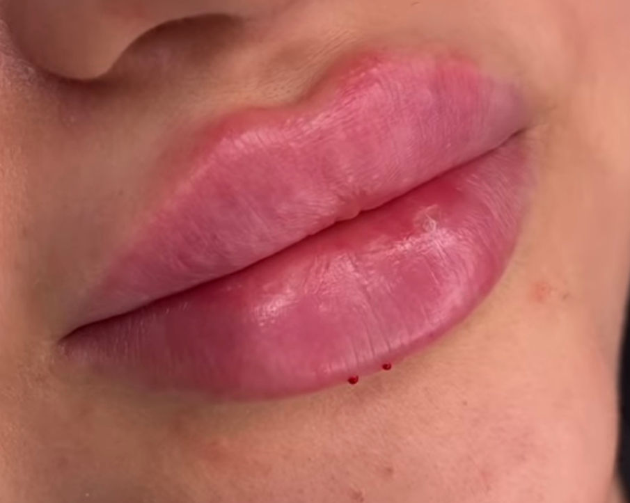 Russian Lips vs Classic Lips