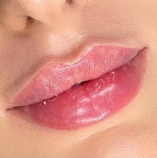 Russian Lips vs Classic Lips