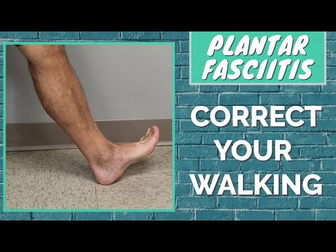 4. LEARN TO WALK CORRECTLY SO YOUR PLANTAR FASCIITIS MAY HEAL